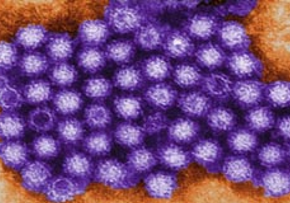 Norovirus outbreak continues at two Greater Victoria hospitals